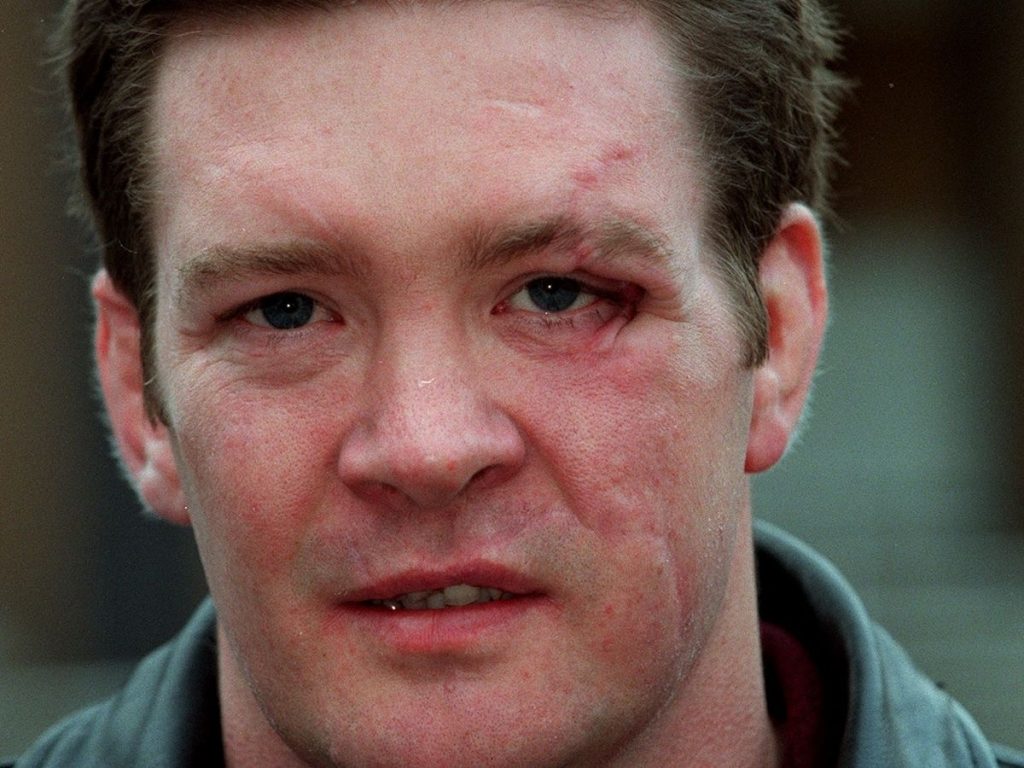 Trevor Rees-Jones: el único sobreviviente del accidente donde murió la ...